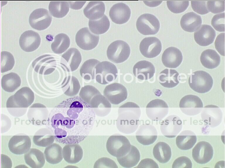 Stomatocytes Photo by cat_at_uw | Photobucket